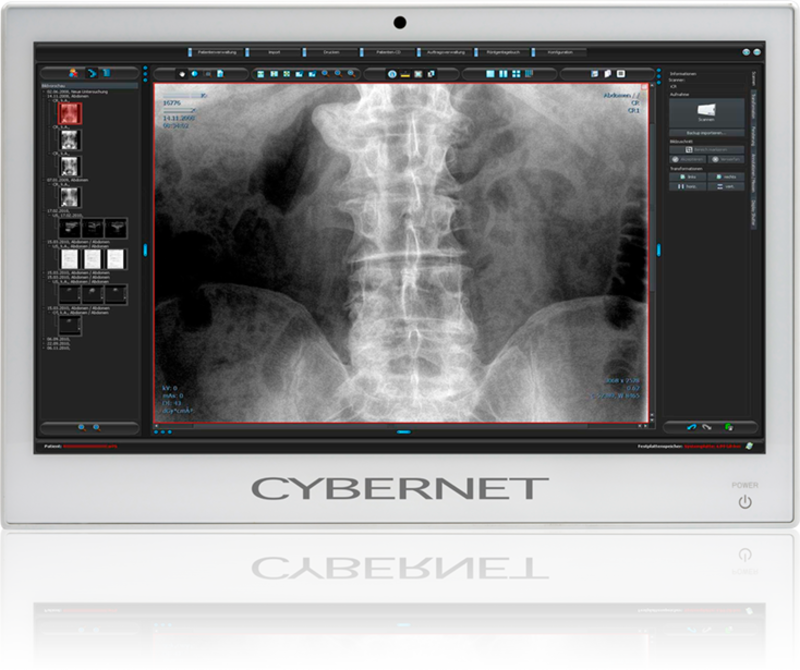 Medical Device Computer | Cybernet